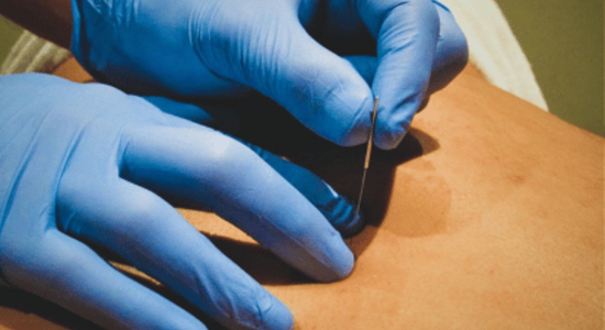 Level 1 Hobart (Nov 2023) | Physiotherapy Course | Nexlec.com