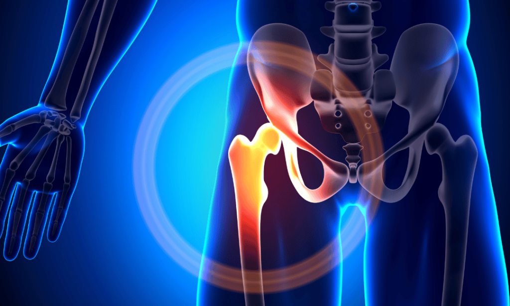 Webinar: Adductor Related Groin Pain | Chiropractic Course