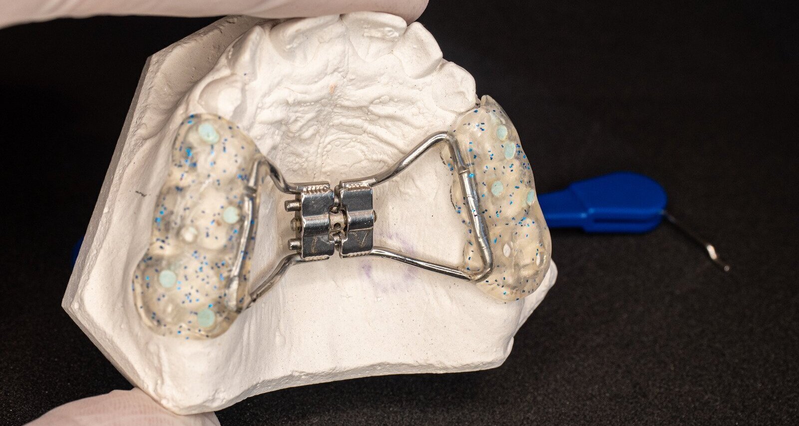 BioBloc and Forward Growth Guidance | Dentistry Course | Nexlec.com