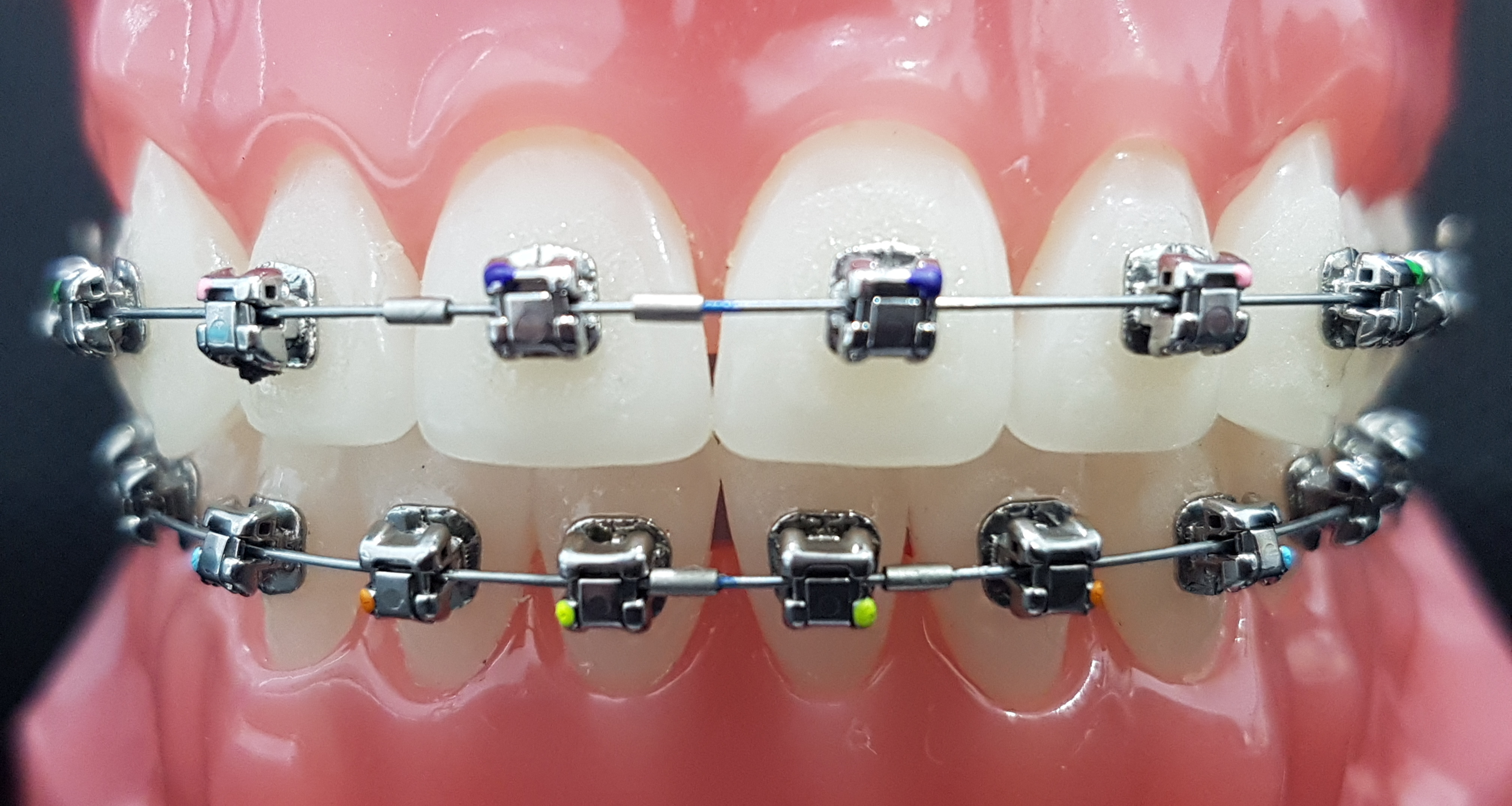 The Damon Series | Dentistry Course | Nexlec.com