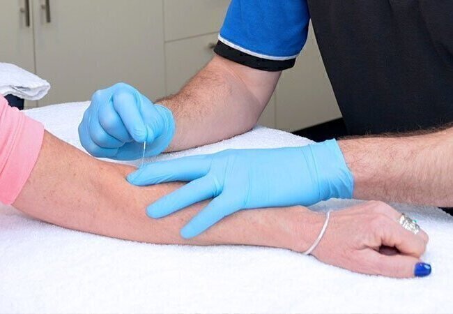 Upper Limb Singapore (May 2024) | Physiotherapy Course | Nexlec.com