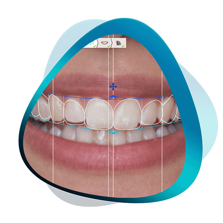 Digital Smile Design | Dentistry Course | Nexlec.com