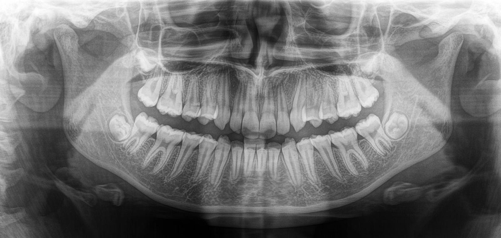 OPG and Lateral Cephalometry Licensing Course - Via Zoom | Dentistry