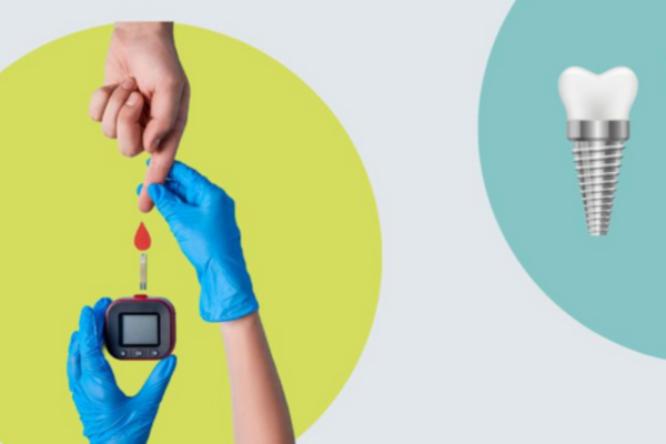 Diabetes and implantology | Feature | Nexlec.com
