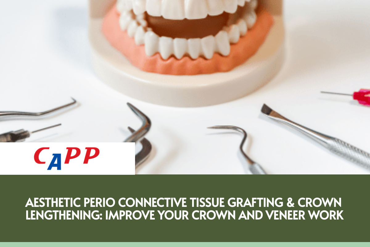 Discover the Secrets of Periodontal Aesthetics and Restorative